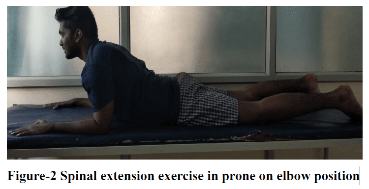 Dynamic Sitting Exercise versus Spinal Extension Exercise on Pain from ...